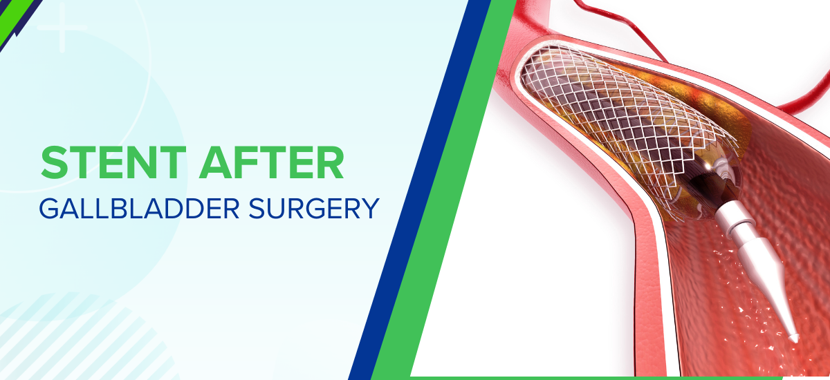 Stent After Gallbladder Surgery | Dr. Vipulroy Rathod